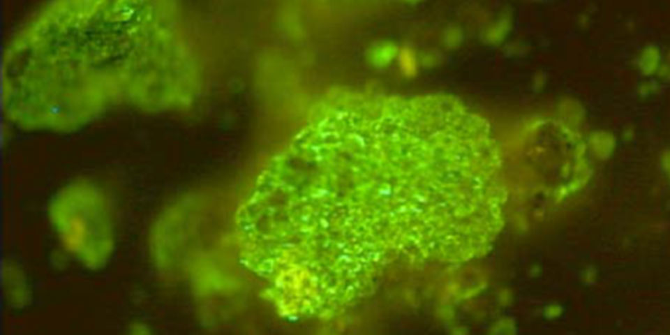 Soil structure and health with AGTIV mycorrhizal fungi and glomalin